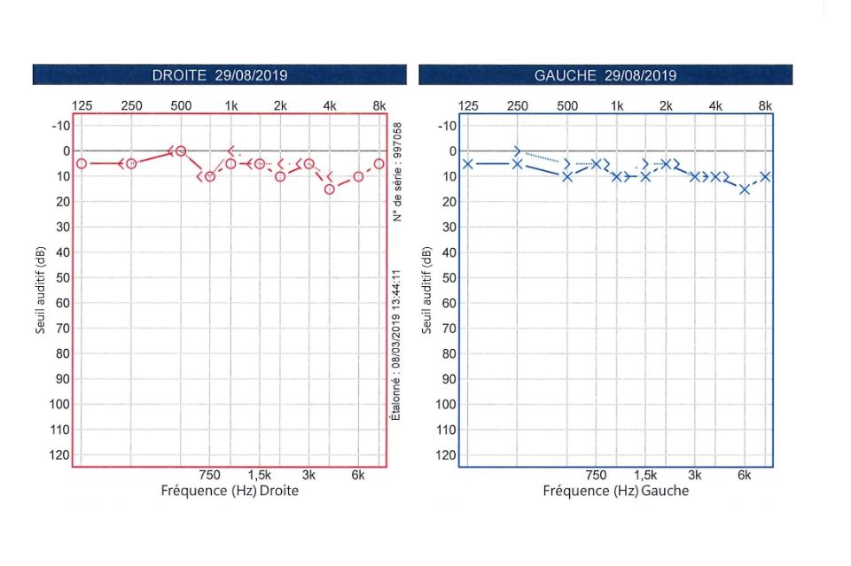 Qu’est-ce qu’un Audiogramme et comment le lire? | Earpros FR